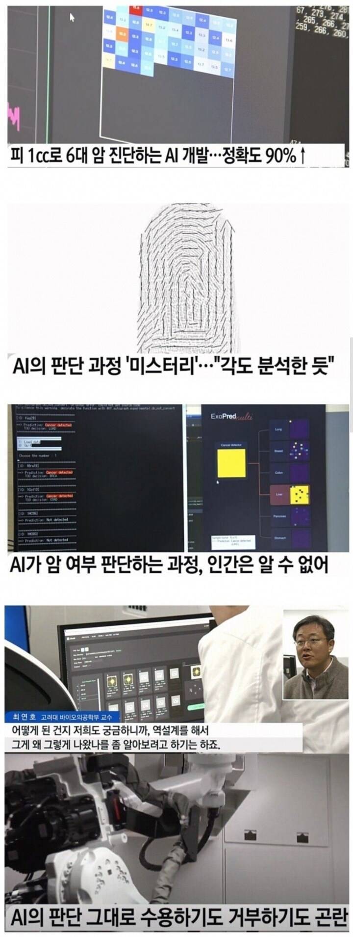 더쿠 Ai를 이용한 암 진단 정확도가 90에 도달함 그런데